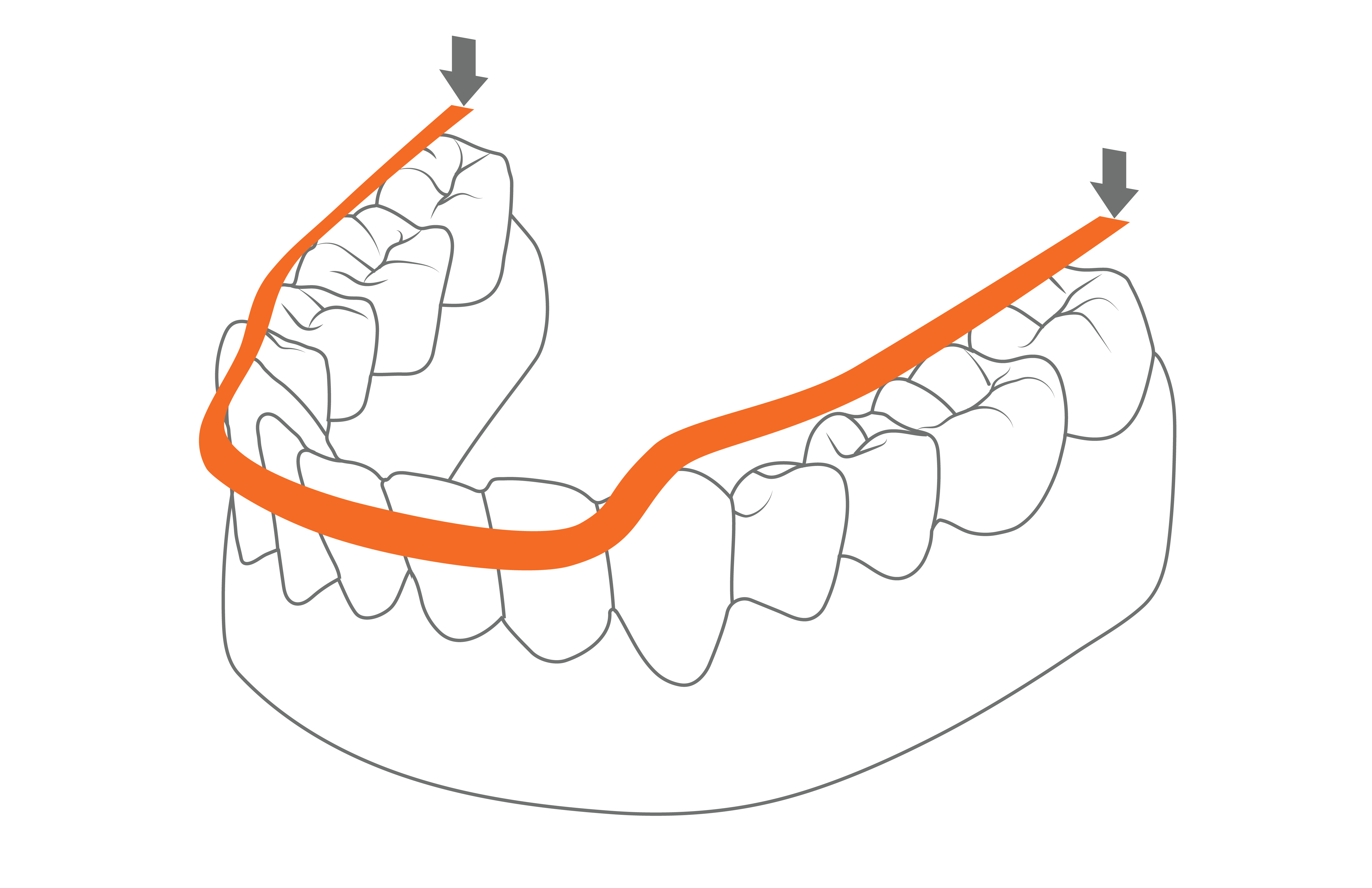 Scanpath strategy - 3DISC Online Help